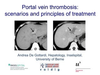 Splenic Vein Thrombosis Anticoagulation