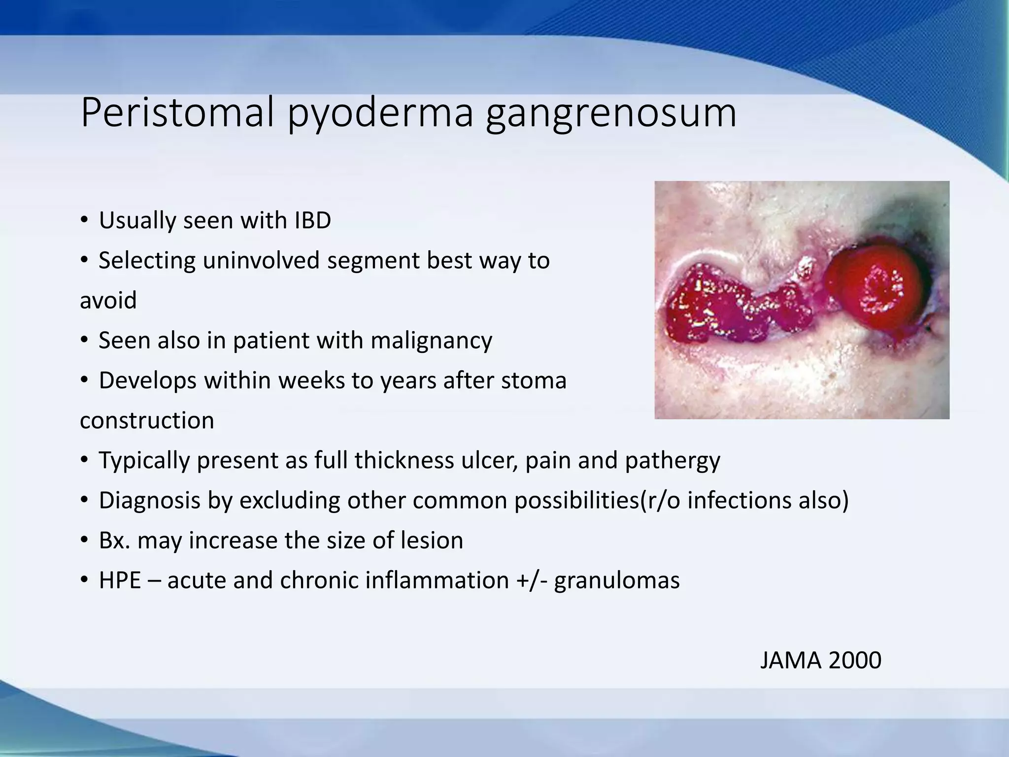 Stoma management | PPTX