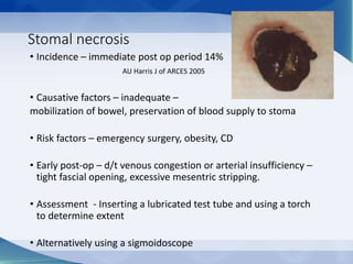 Stoma management | PPTX