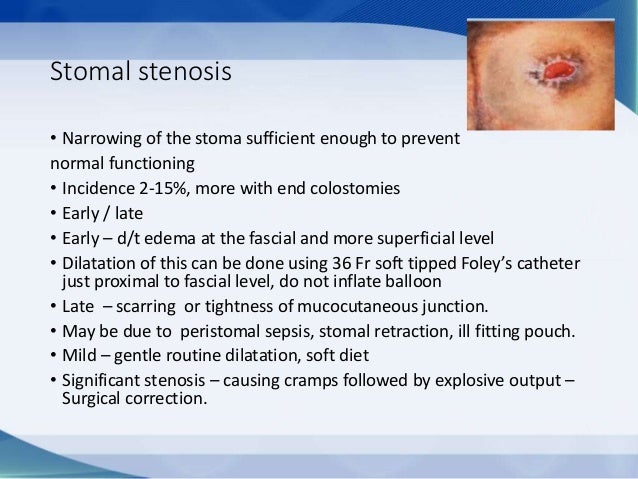 Stoma management