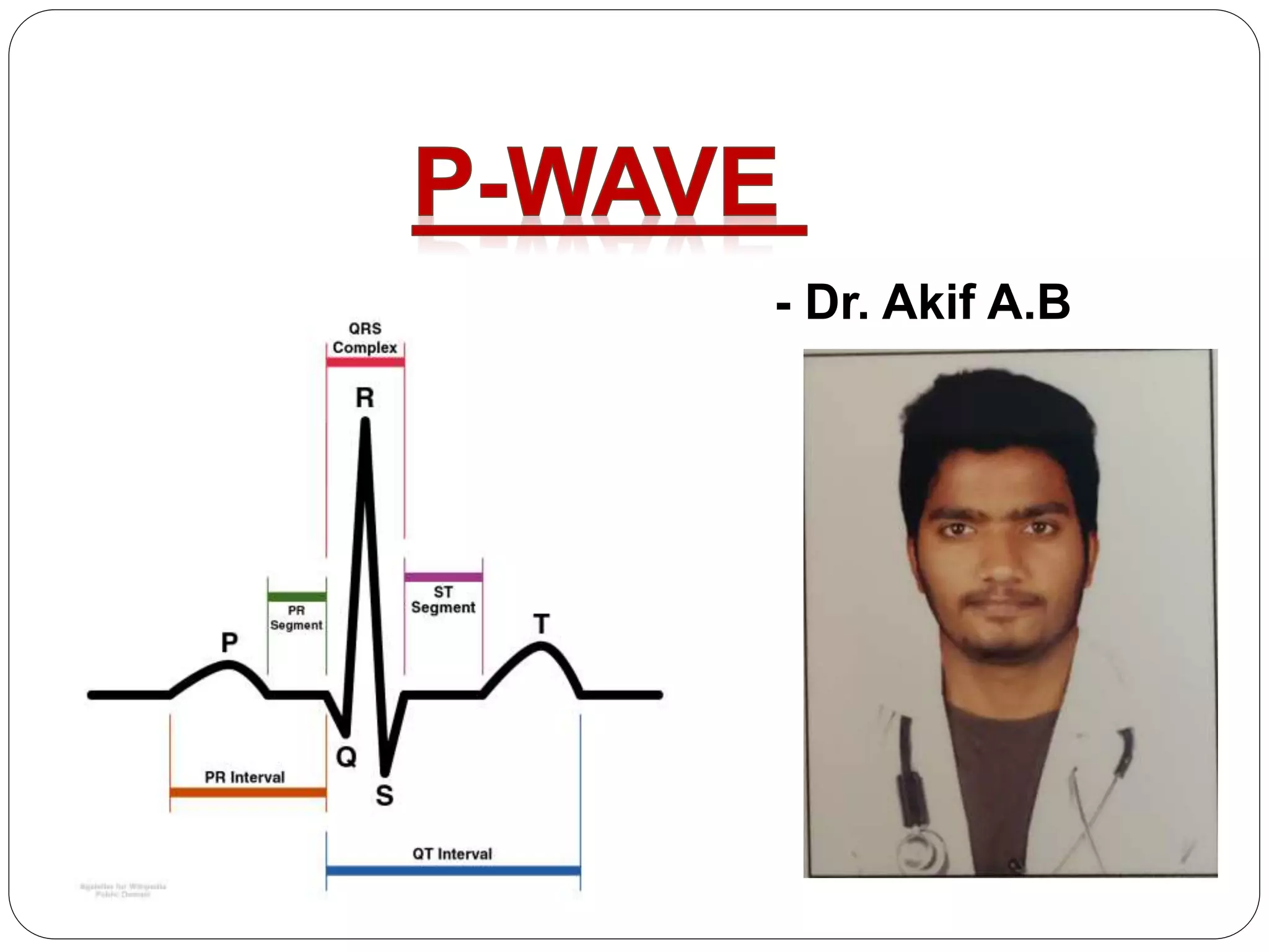 P wave (ECG) - Dr. Akif Baig | PPTX