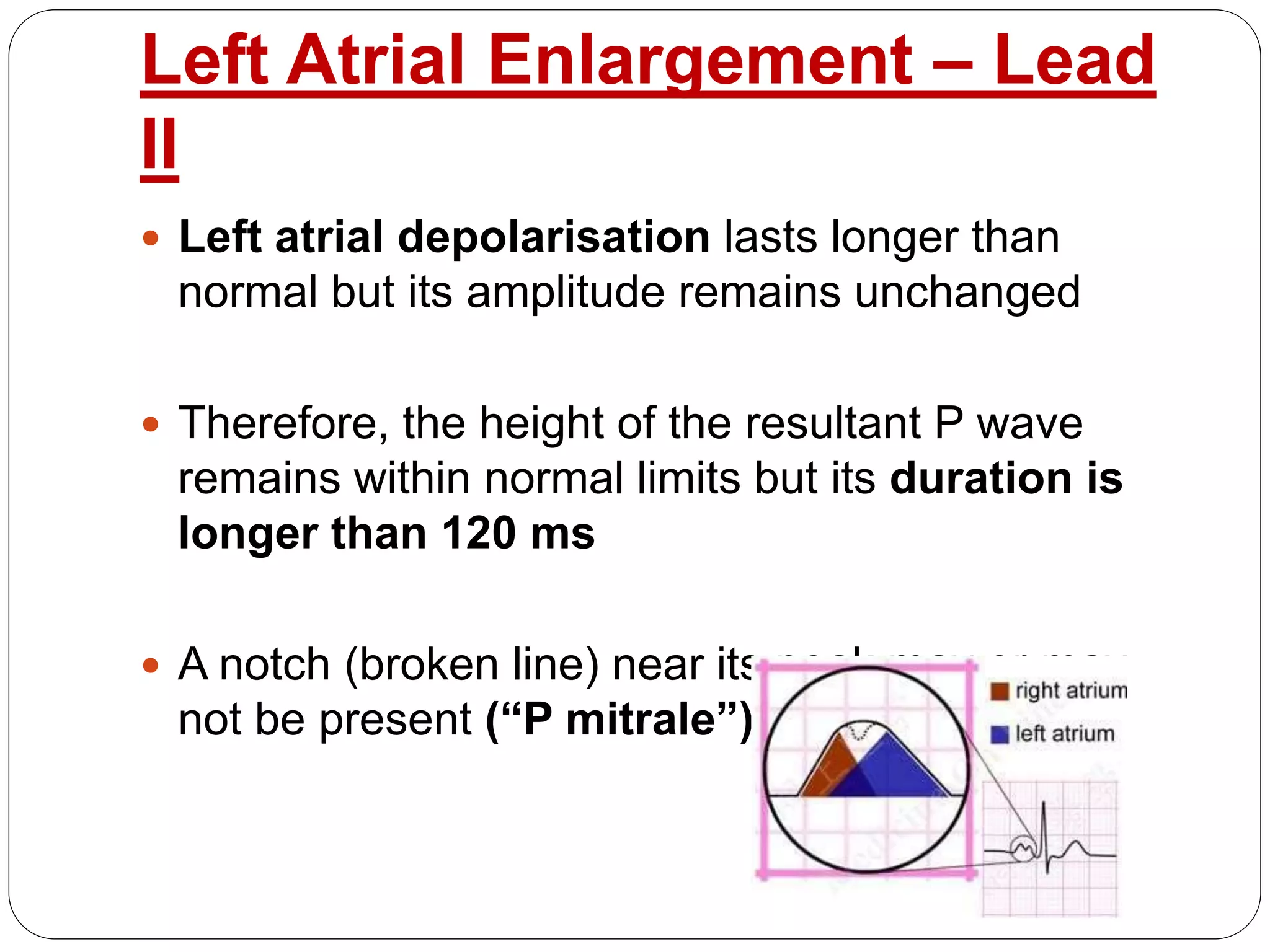 P wave (ECG) - Dr. Akif Baig | PPTX