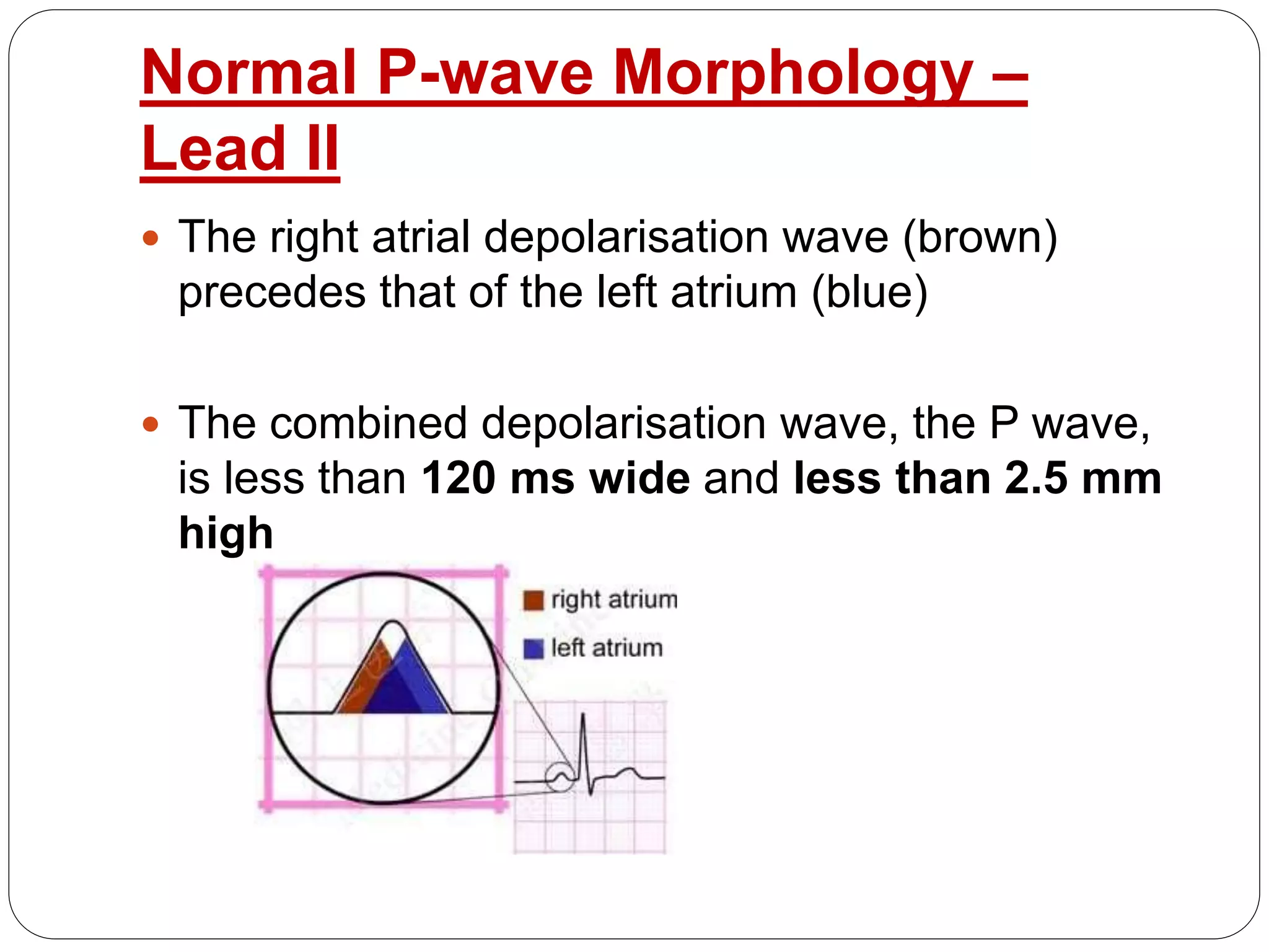 P wave (ECG) - Dr. Akif Baig | PPTX
