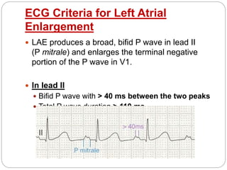 P wave (ECG) - Dr. Akif Baig | PPTX