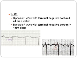 P wave (ECG) - Dr. Akif Baig | PPTX