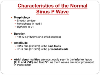 P wave (ECG) - Dr. Akif Baig | PPTX