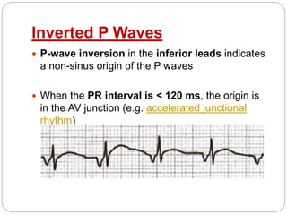 P wave (ECG) - Dr. Akif Baig | PPTX