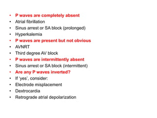 P WAVE IN ECG,ABNORMALITIES OF P WAVE IN ECG | PPTX