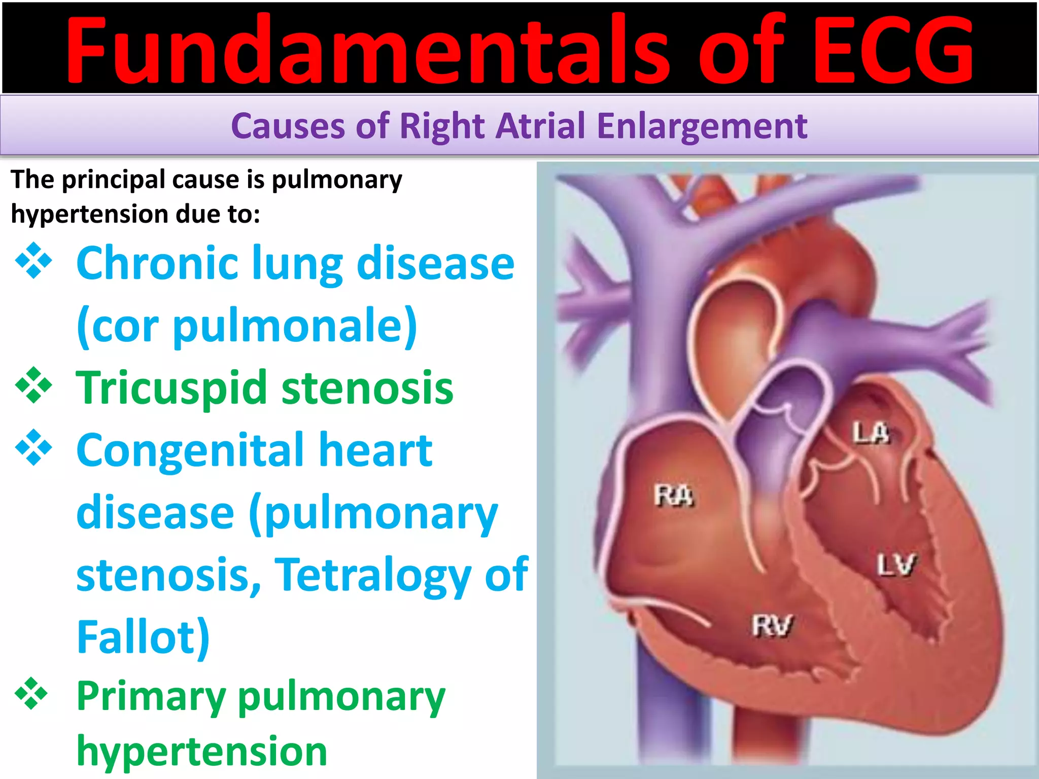 P wave abnormalities in ECG | PPSX