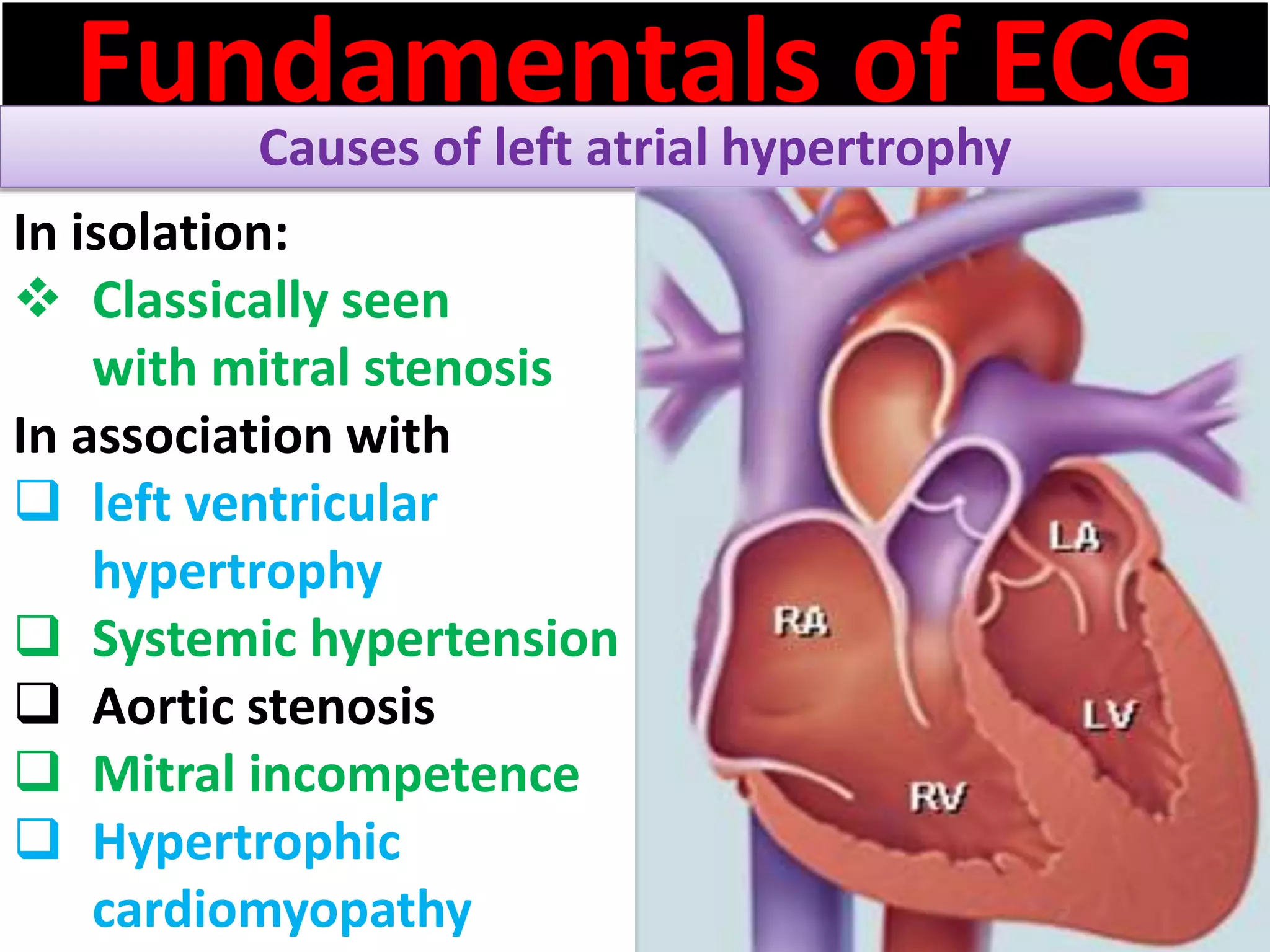 P wave abnormalities in ECG | PPSX