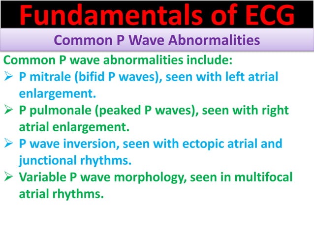 P wave abnormalities in ECG | PPSX | Heart and Cardiovascular Diseases | Diseases and Conditions