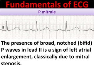 P Mitral Left: The Anatomical Reciprocal Position Of The Aortic,