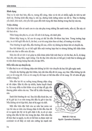 CHUYỂN DẠ BẤT THƯỜNG | PDF