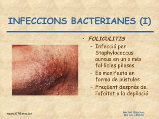 Pwp La Pell Malalties Infeccioses | PPT