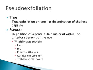 pseudoexfoliative glaucoma | PPTX