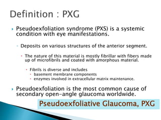 Pseudoexfoliative Glaucoma