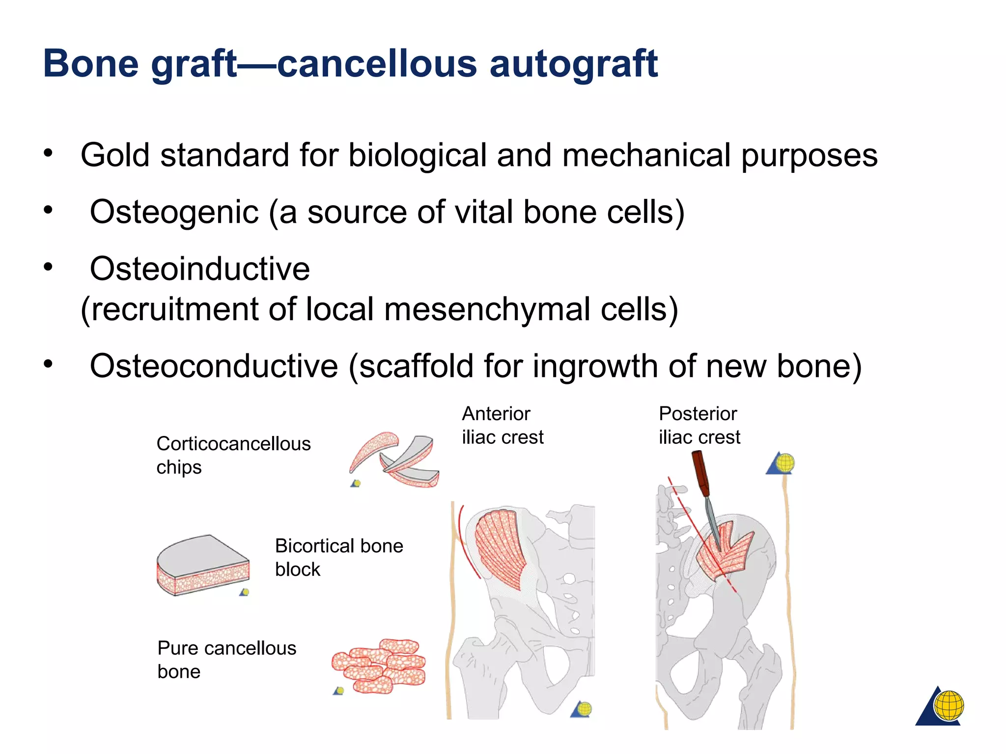 Delayed mal non union | PPT