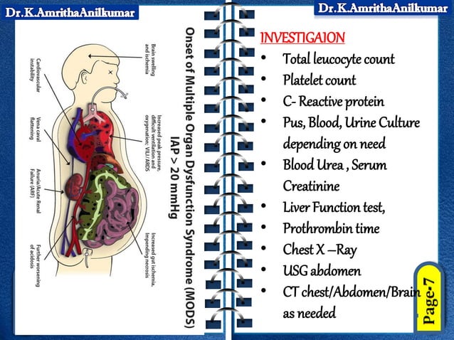 Pyaemic abscess by Dr.K.AmrithaAnilkumar