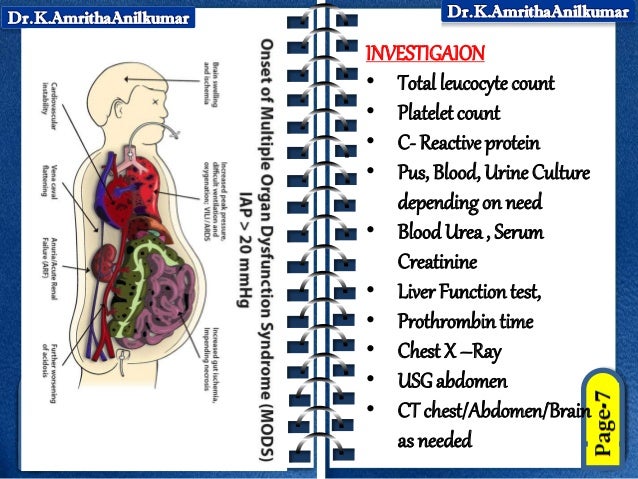 Pyaemic abscess by Dr.K.AmrithaAnilkumar