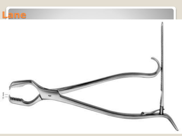 Pyelolithotomy, | PPTX