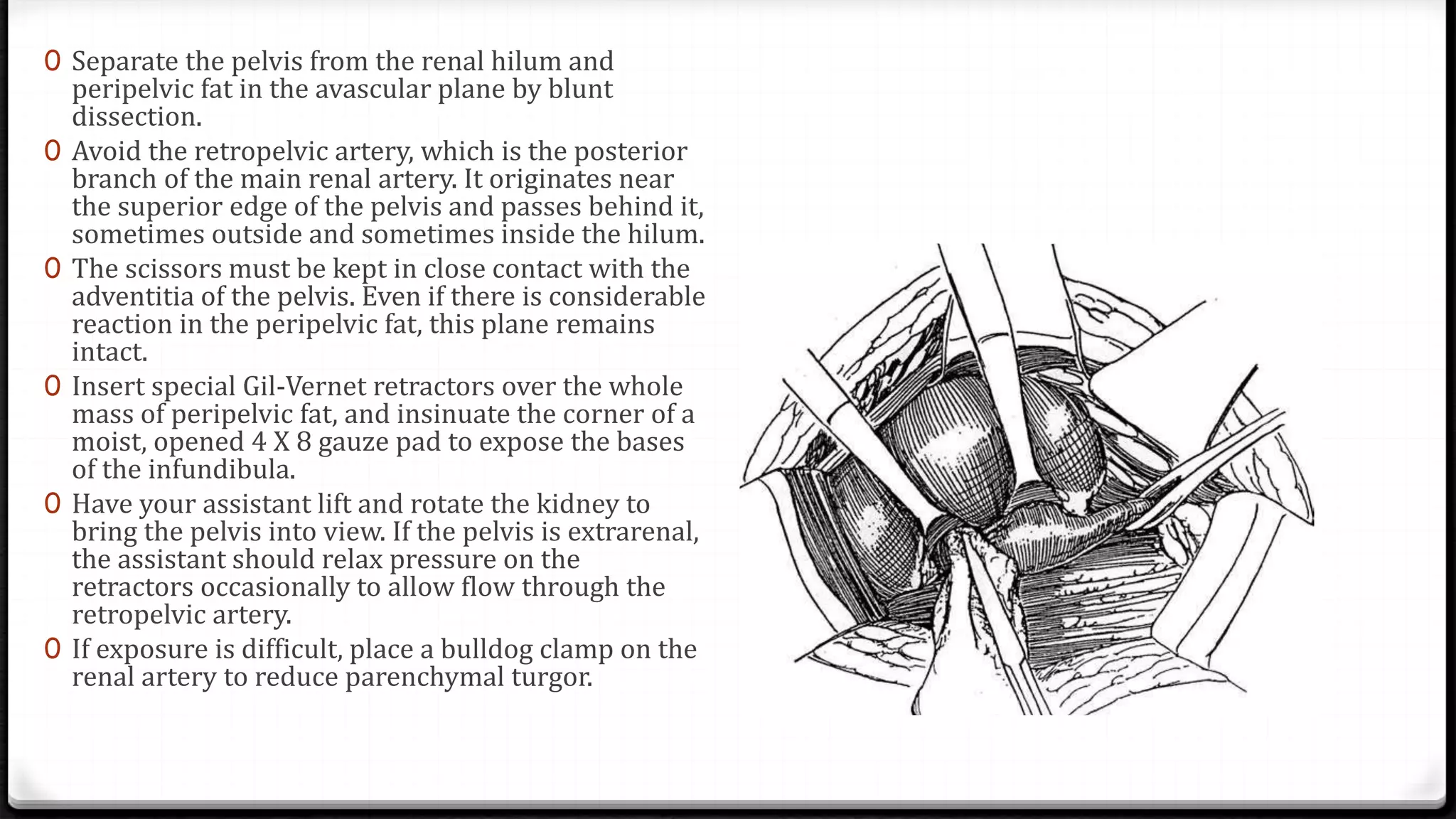 Open Pyelolithotomy | PPTX