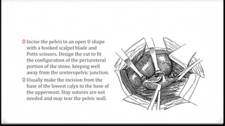 Open Pyelolithotomy | PPTX