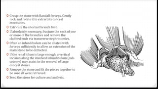 Open Pyelolithotomy | PPTX