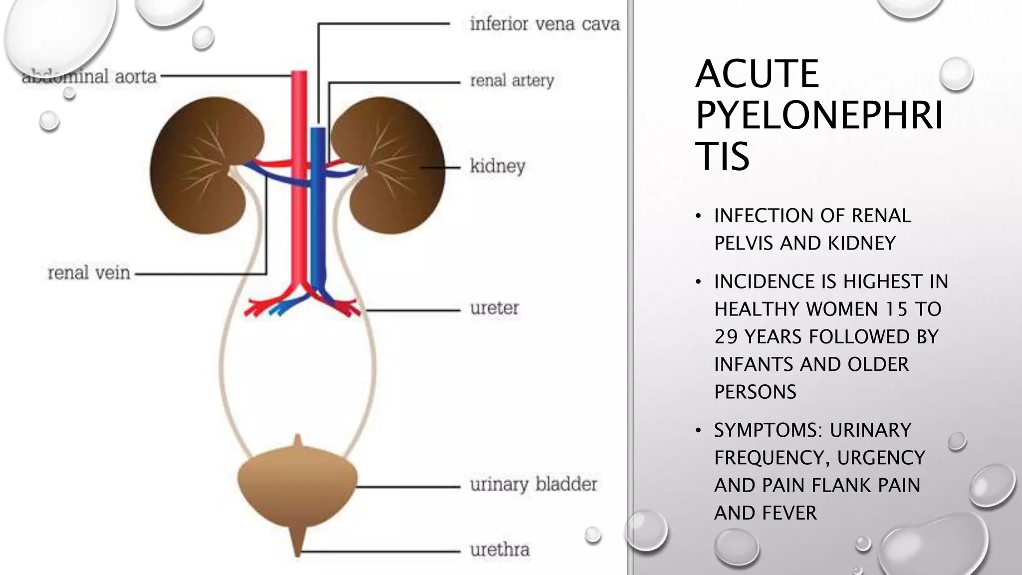Pyelonephritis | PPTX