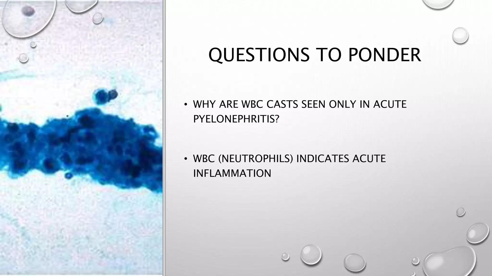 Pyelonephritis | PPTX