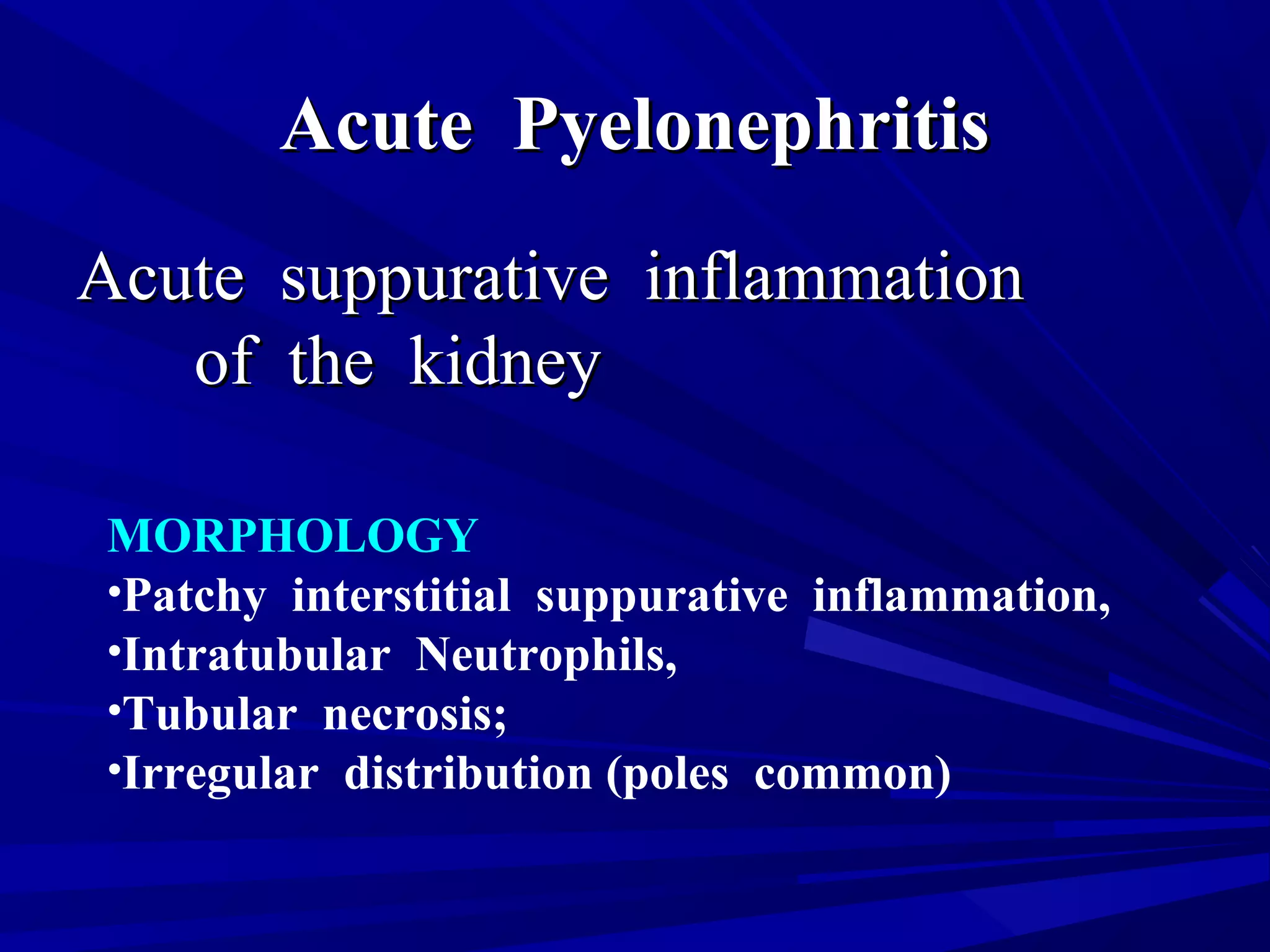 Pyelonephritis csbrp | PPT