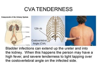 Costovertebral Angle Tenderness Causes