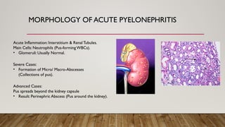 pyelonephritis it is infection or inflammation of kidney.pptx