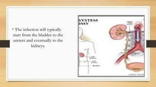 Pyelonephritis and Cystitis.pptx
