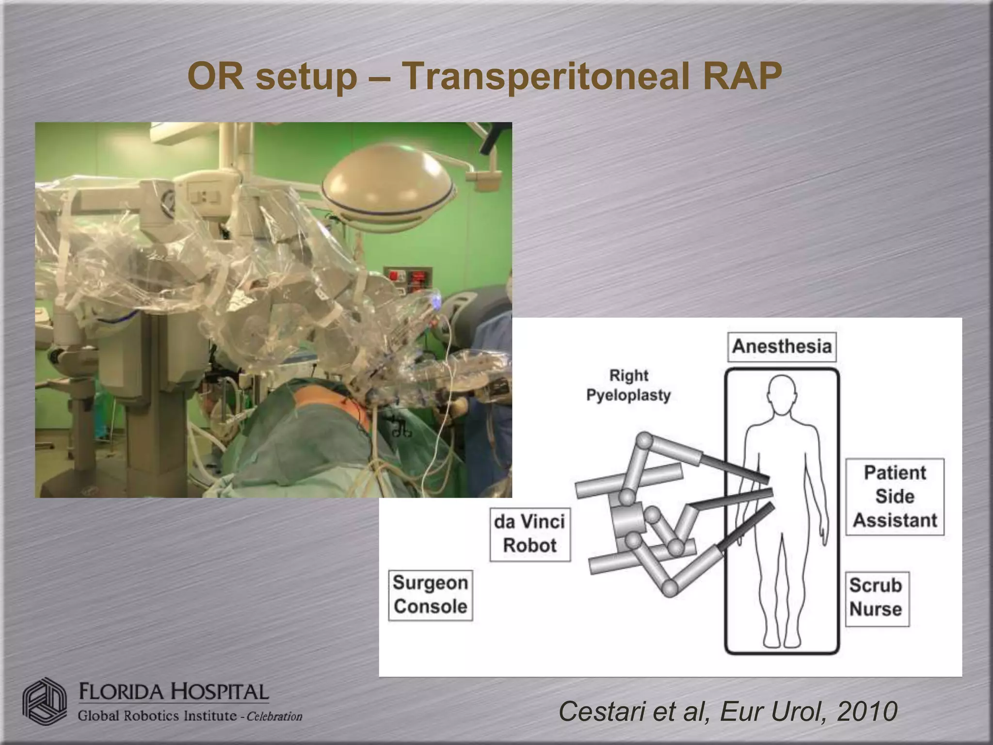 Robotic-Assisted Pyeloplasty | PPTX