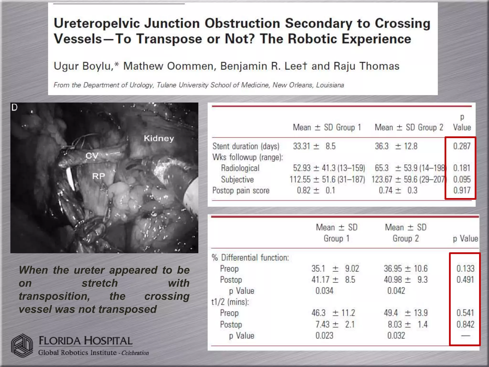 Robotic-Assisted Pyeloplasty | PPTX
