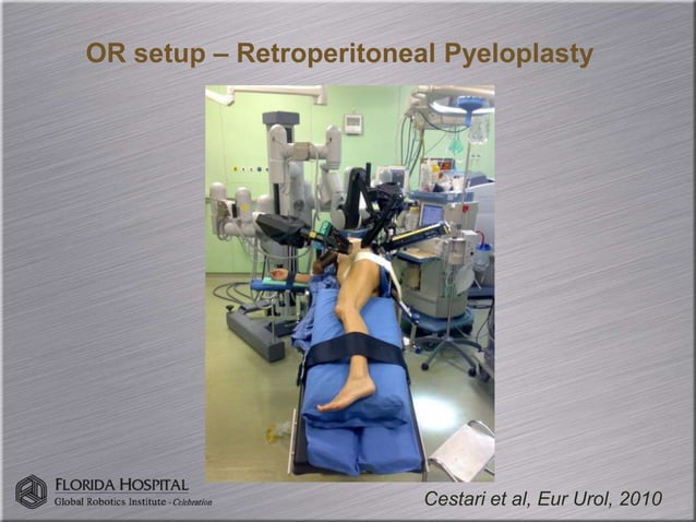 Robotic-Assisted Pyeloplasty | PPTX