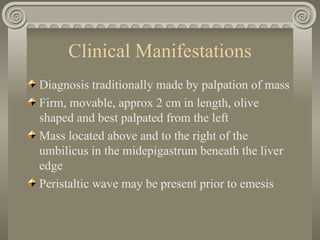 Pyloric Stenosis | PPT