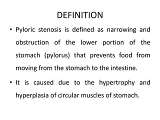 Pyloric stenosis Child Health Nursing | PPTX