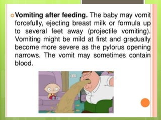 Projectile Vomiting Family Guy