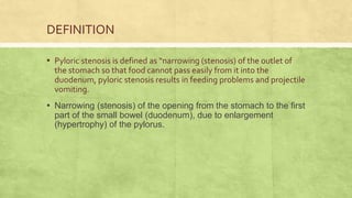 Pyloric stenosis | PPTX