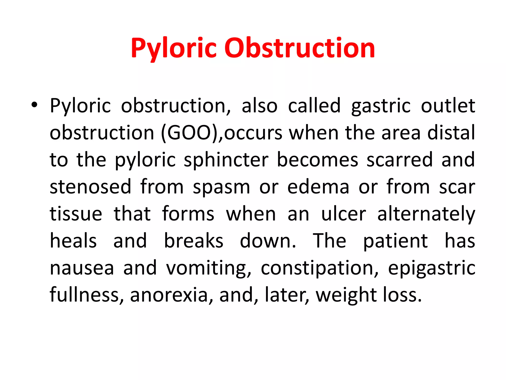 Pyloric Stenosis.pptx