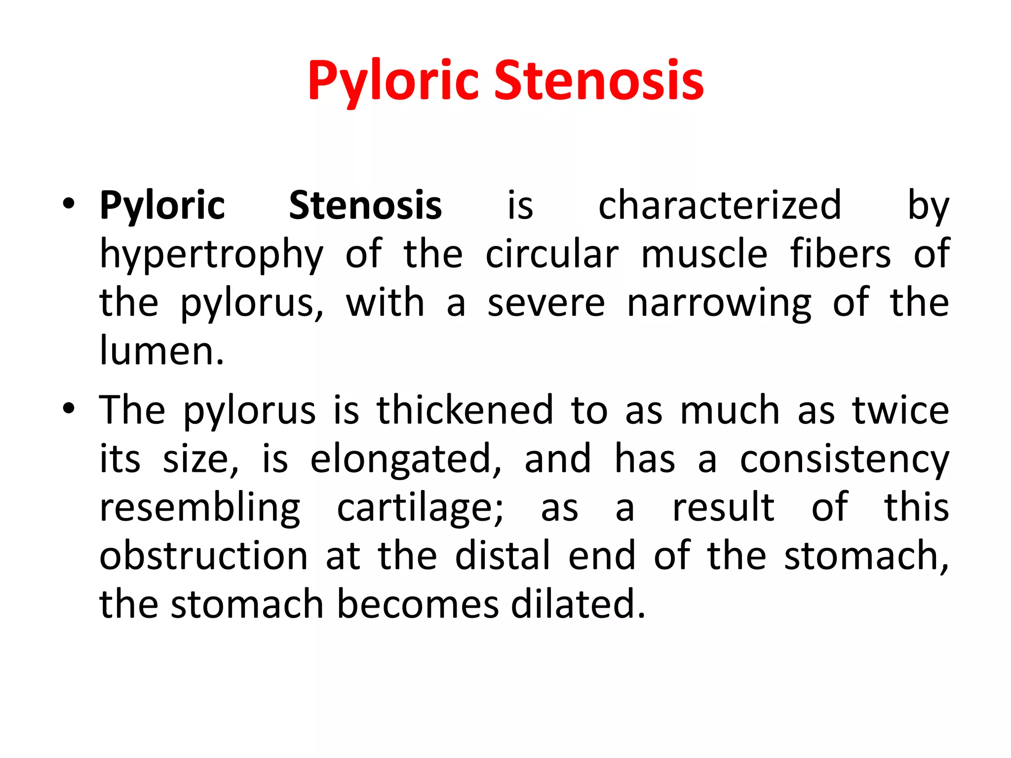 Pyloric Stenosis.pptx