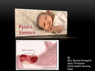 Pyloric stenosis.pptx | Pregnancy | Reproductive Health
