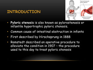 Pyloric stenosis.pptx