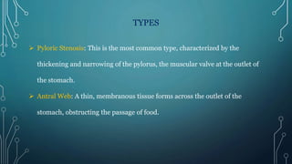 Pyloric stenosis.pptx