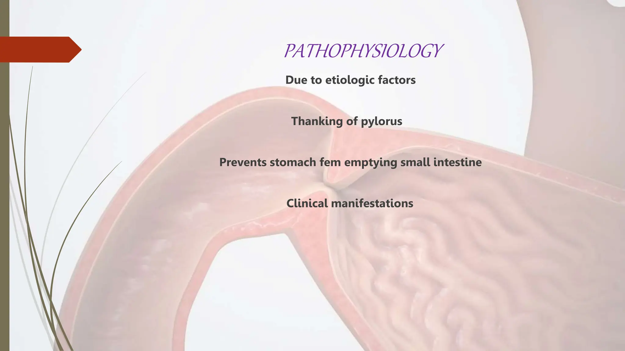 Nursing Management of Patients with PYLORIC STENOSIS.pptx