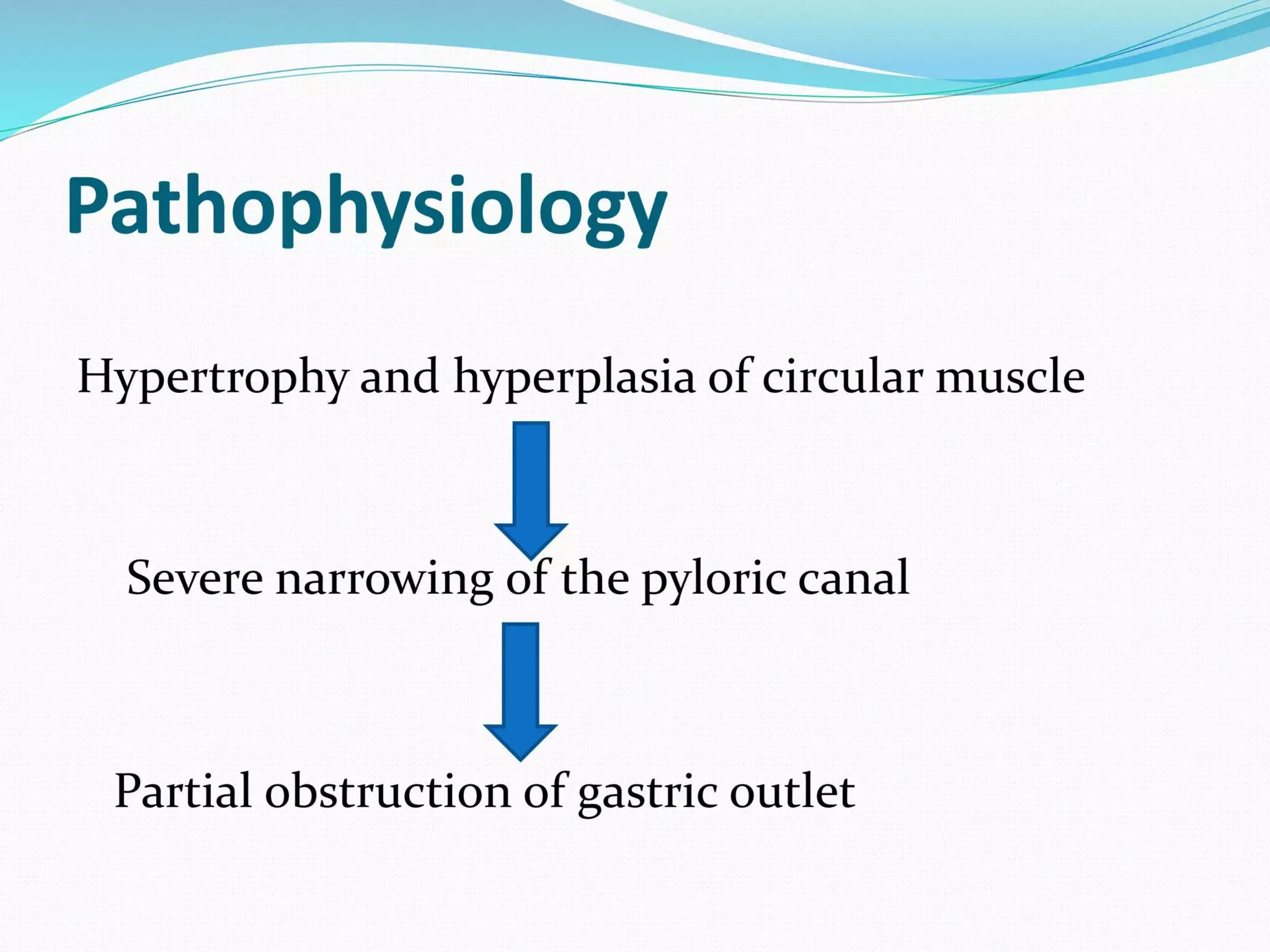 pyloric stenosis .pptx