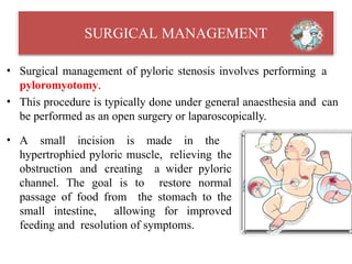 pyloric stenosis .pptx