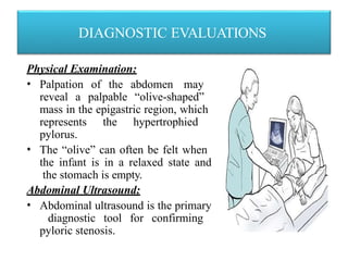 pyloric stenosis .pptx