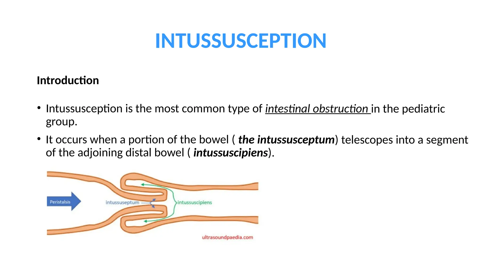 PYLORIC STENOSIS AND ISS Surgery essential.pptx